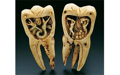 Teeth in Folklore - The Dr. Samuel D. Harris National Museum of Dentistry